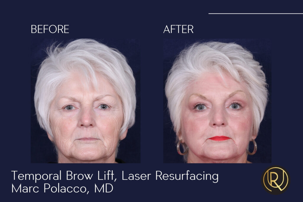 Surgical Gallery | Revitalize U